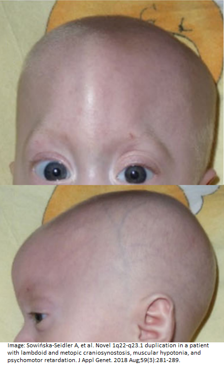 Trigonocephali - NHI.no